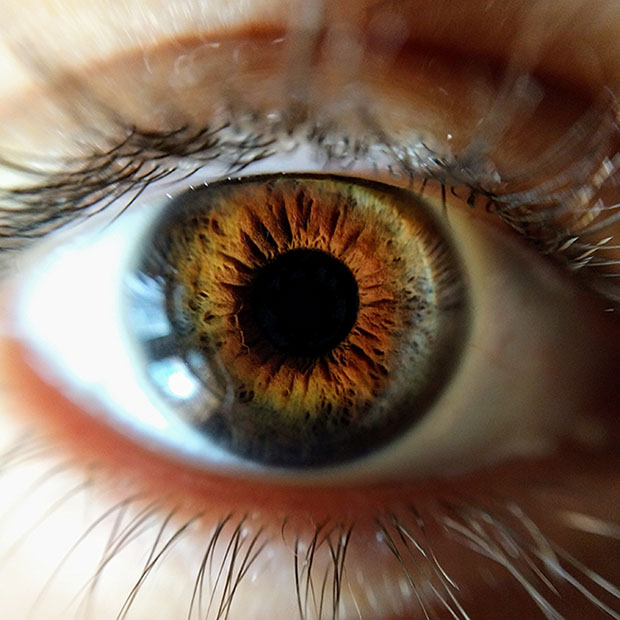 How Autoimmune Diseases Impact Eyesight – Minot ND | Eyes on Burdick